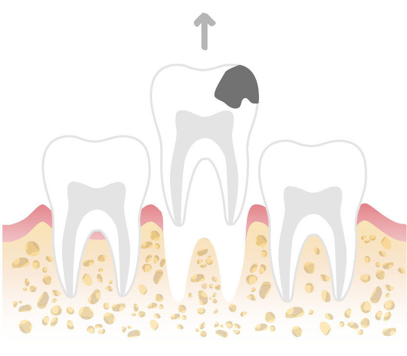 Implantološki Inštitut